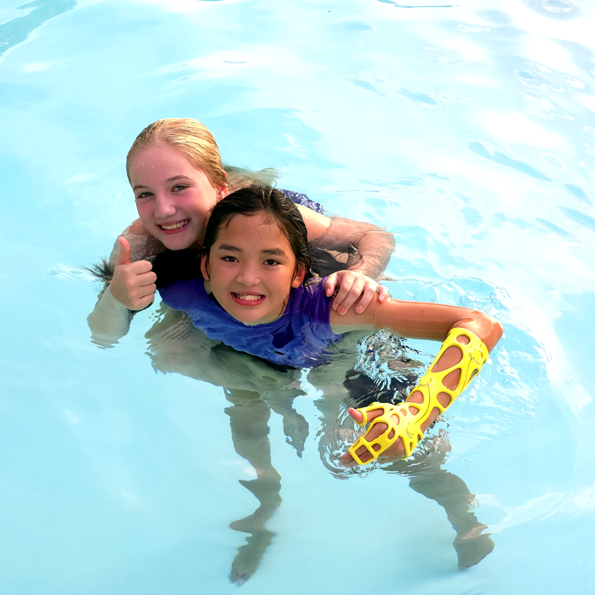 Introducing Freedom Cast, the Waterproof Cast - Freedom Cast